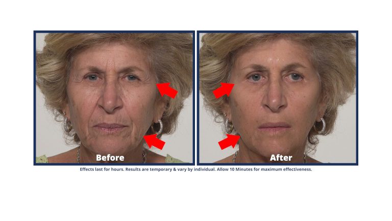 Why I Tried Plexaderm And What It Did For Me