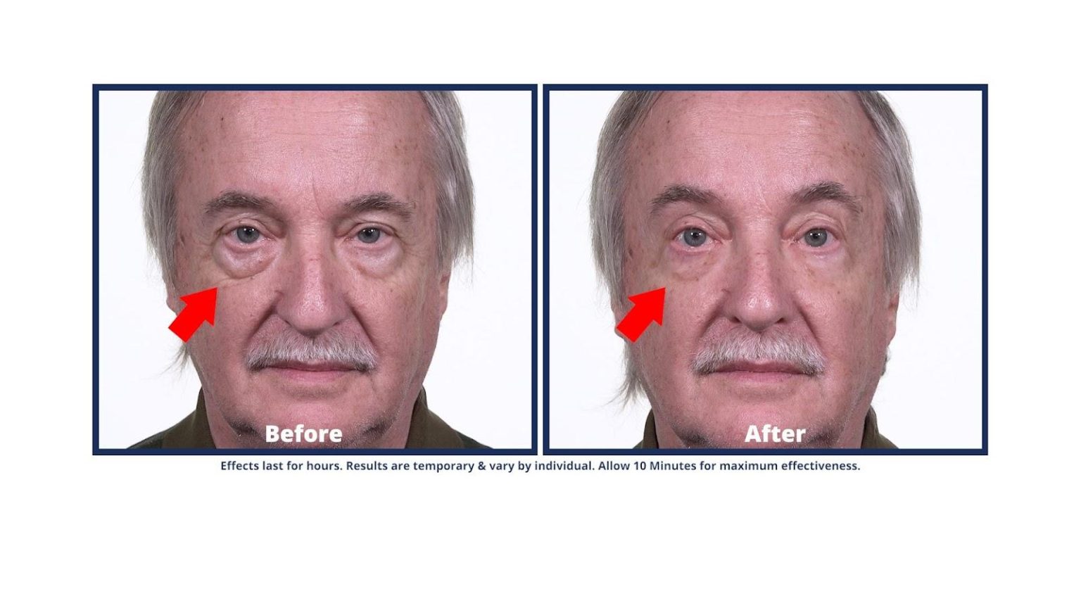 Why I Tried Plexaderm And What It Did For Me